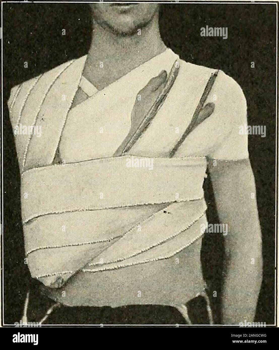 Jaw fracture hi-res stock photography and images - Alamy