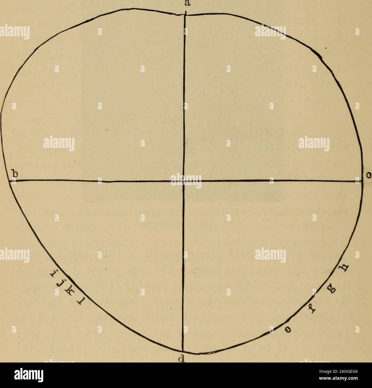 Diseases of the heart and circulation in infancy and adolescence . ed ...