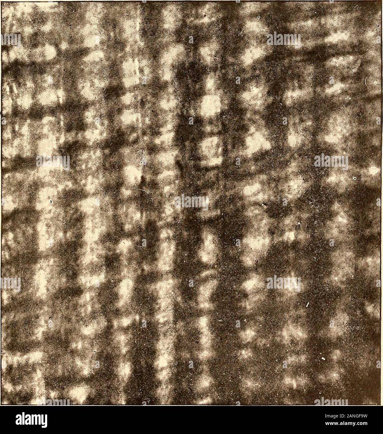 Enamel rods hi-res stock photography and images - Alamy