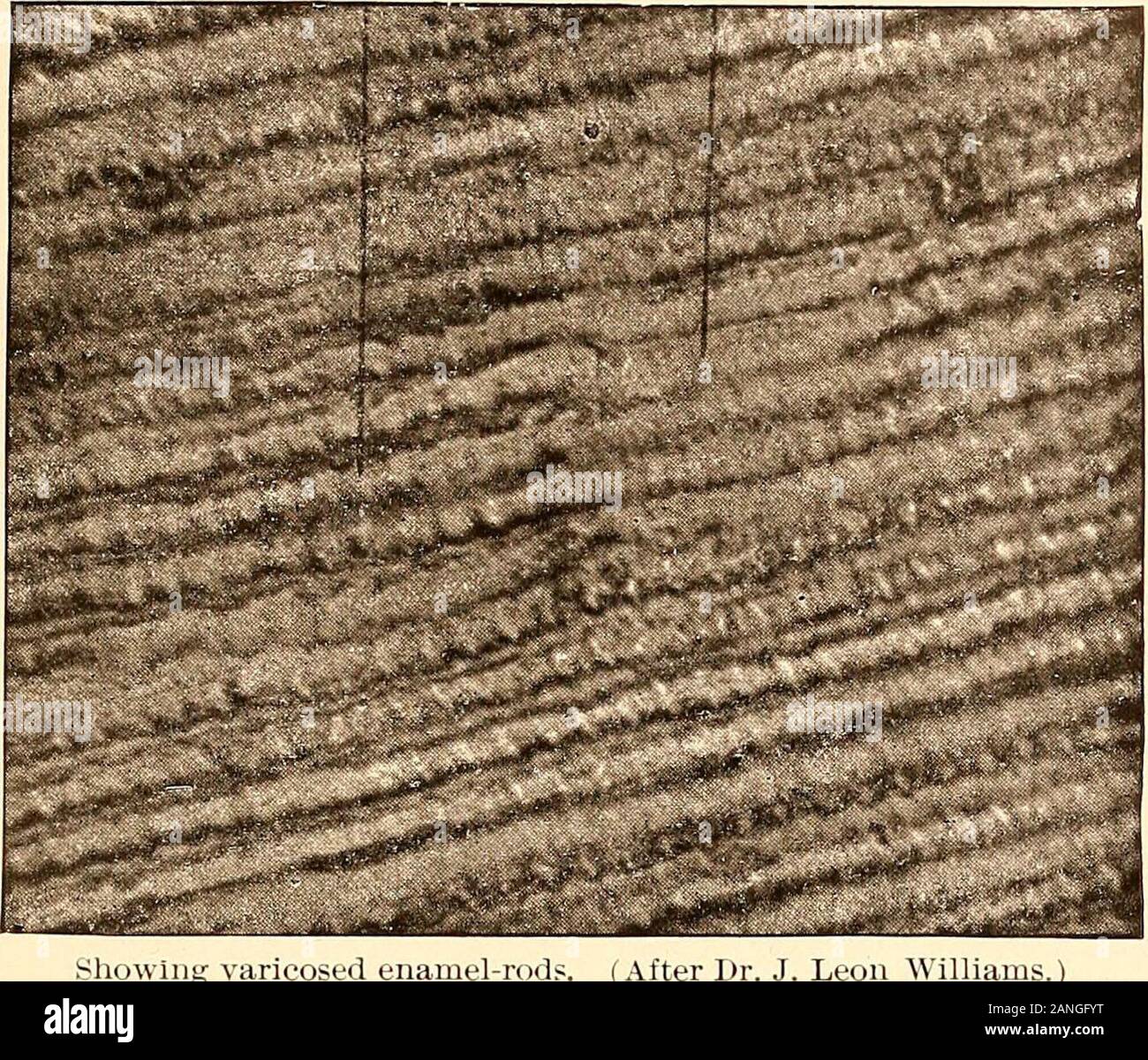 Enamel rods hi-res stock photography and images - Alamy