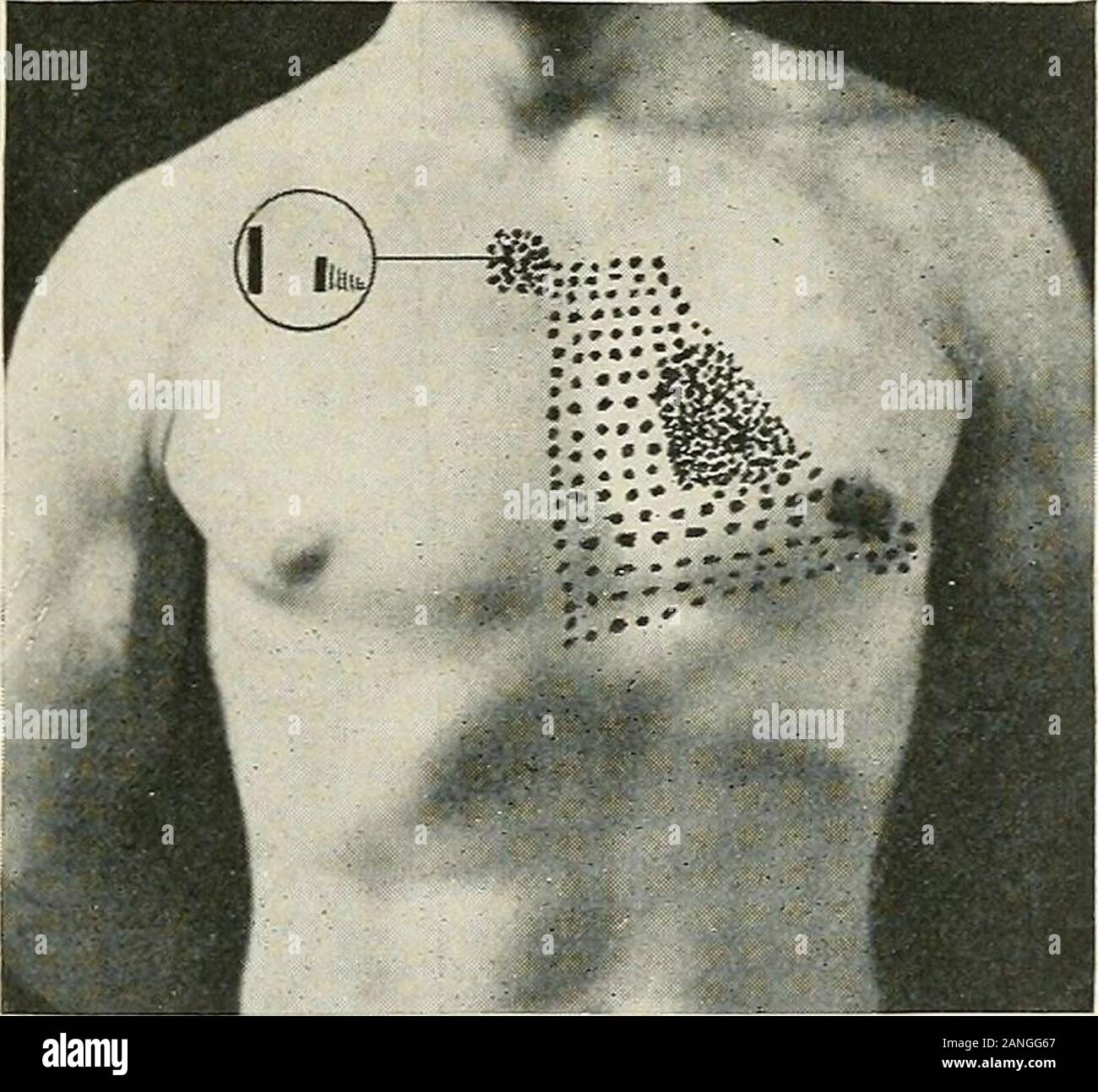 Diseases of the chest and the principles of physical diagnosis . Fig ...