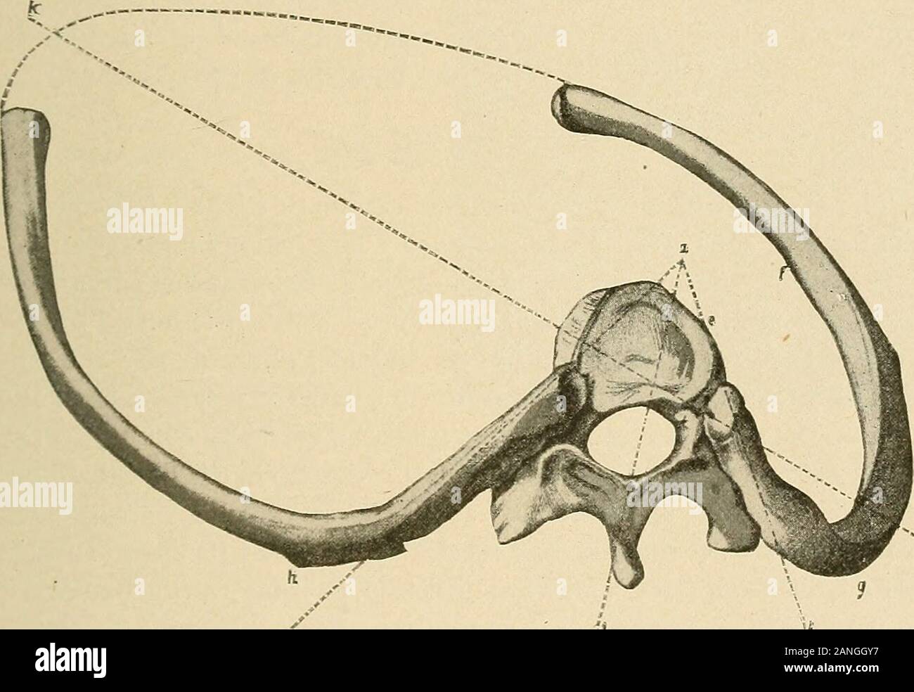 Lateral curvature of the spine and round shoulders . ed as a ...