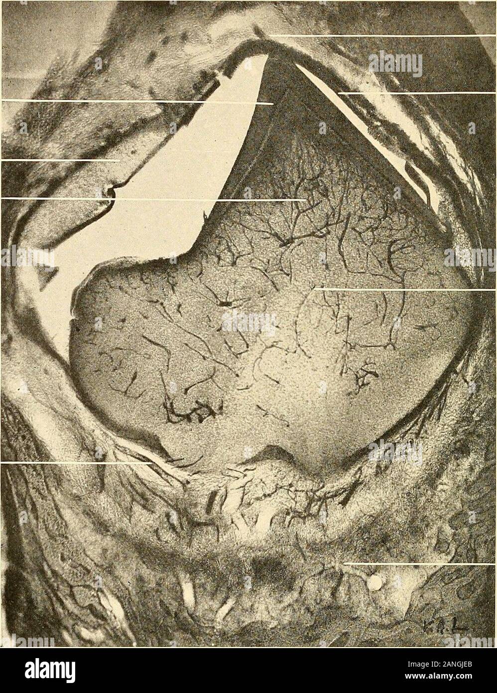 Principles and practice of operative dentistry . Fig. 123.—Vertical ...