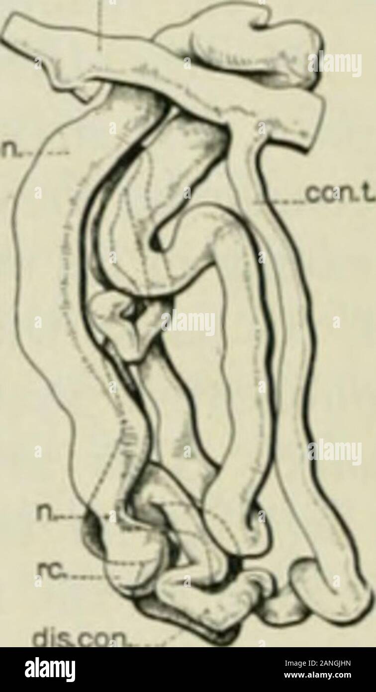 Distal ureter hi-res stock photography and images - Alamy