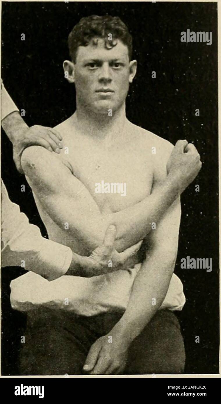 The practice of surgery . Fig. 556.—Examination of shoulder. Movements ...