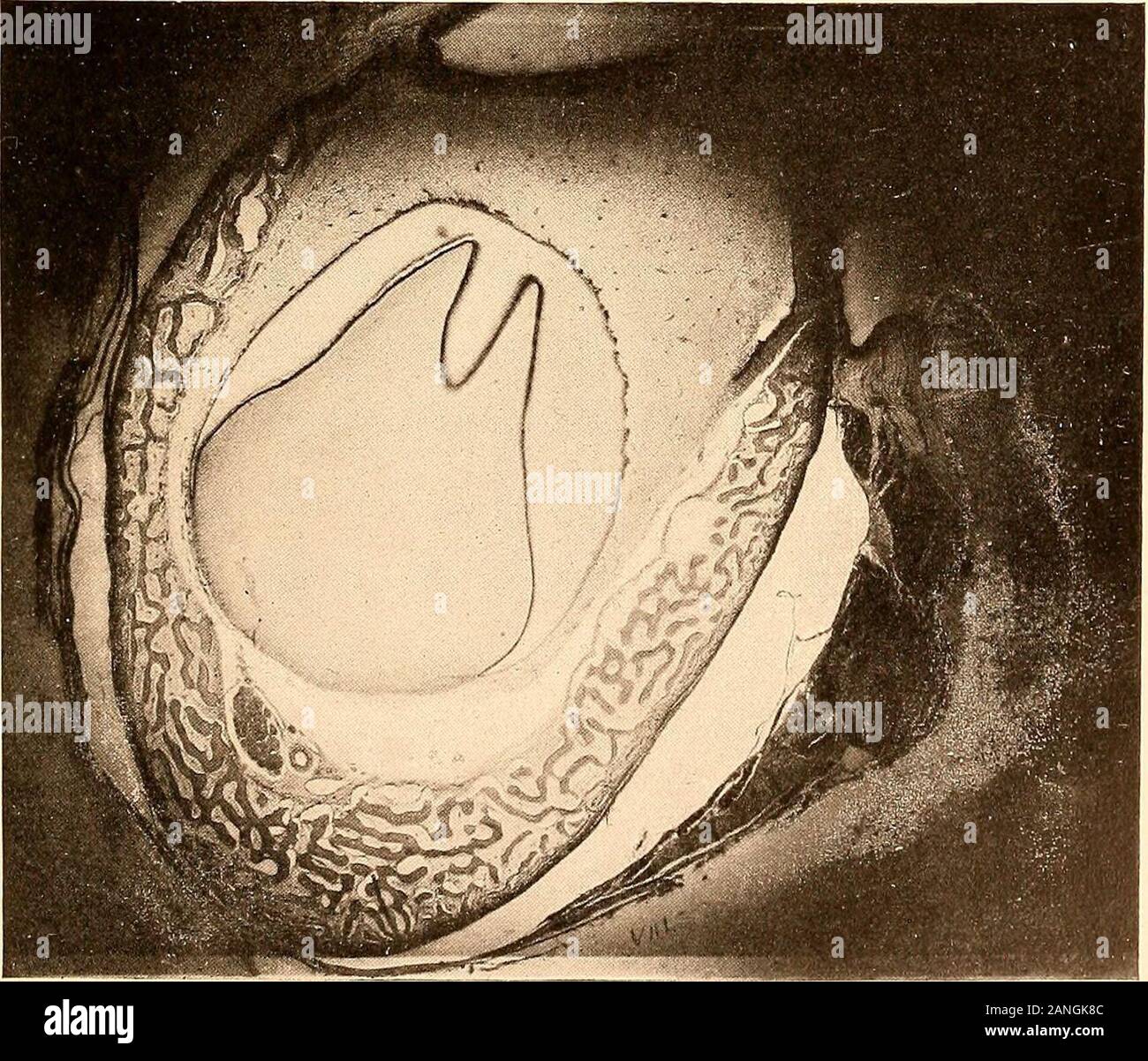Principles and practice of operative dentistry . Fig. 122.—Section of ...