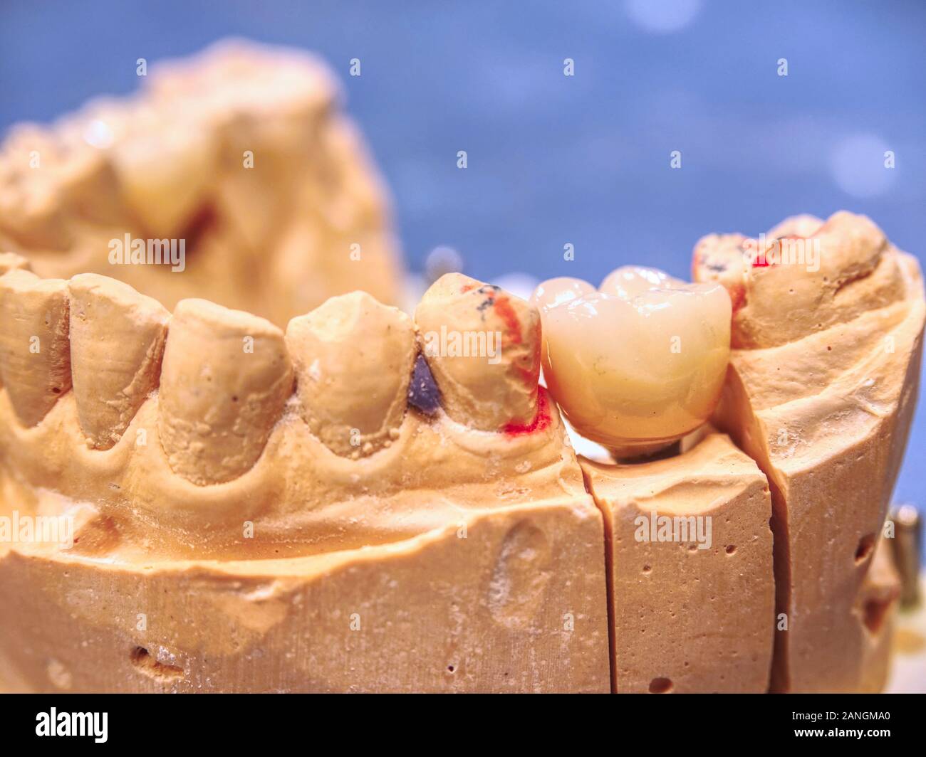 Fixation cement hi-res stock photography and images - Alamy