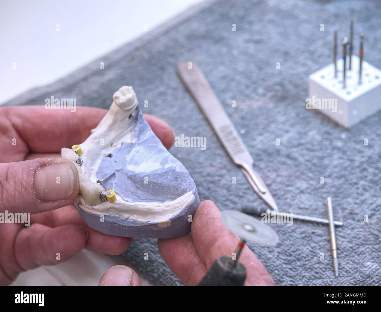 Dental prosthetics work with tools and ceramic crown denture ...