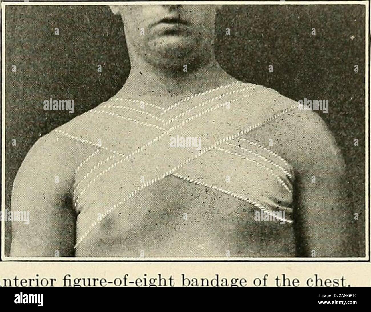 Shoulder Bandage First Aid