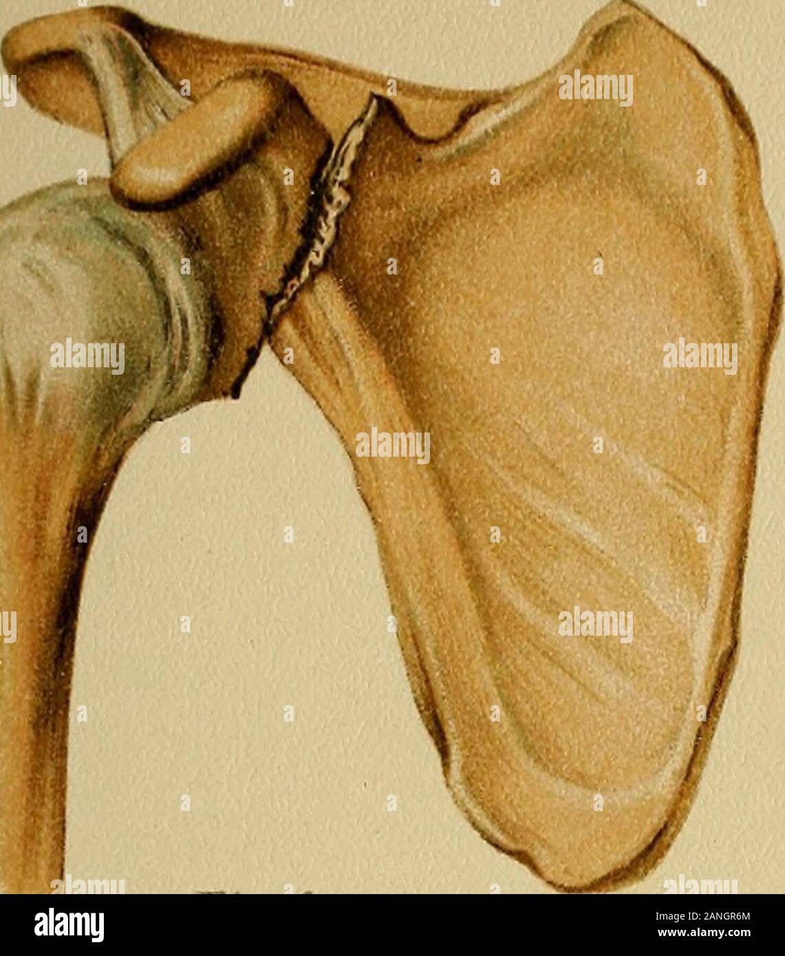 Atlas and epitome of traumatic fractures and dislocations . Fig. 46 ...