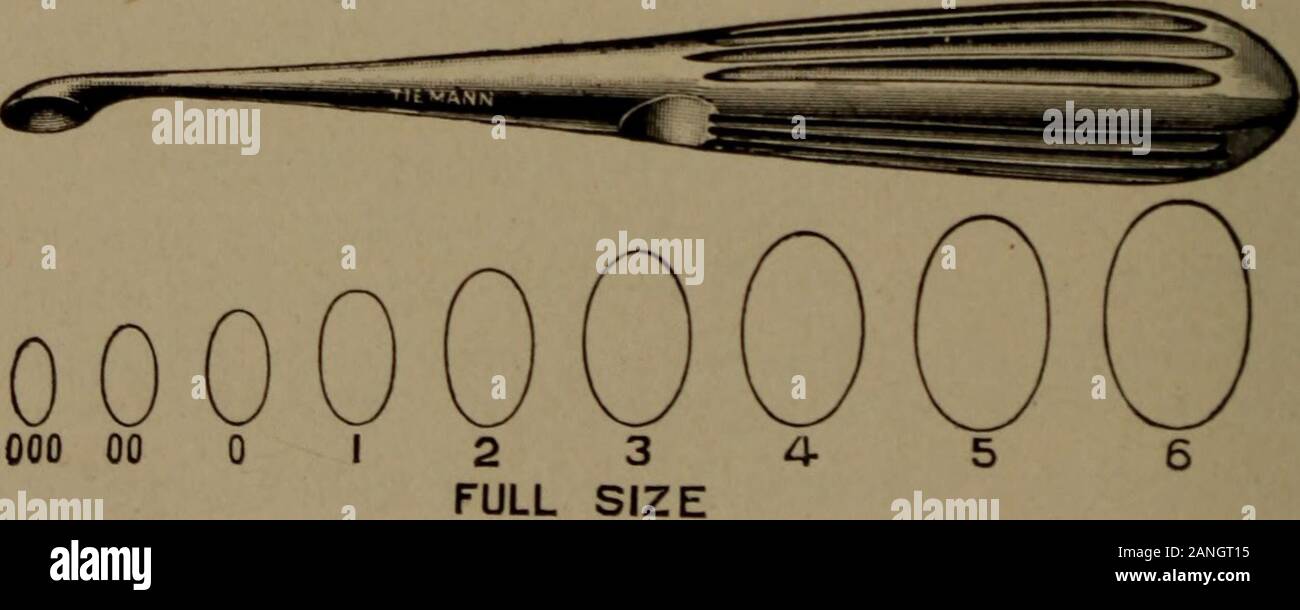 A manual of otology for students and practitioners . Fig. 61.—Yansens ...
