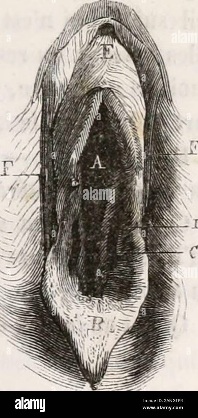 Crico tracheal hi-res stock photography and images - Alamy