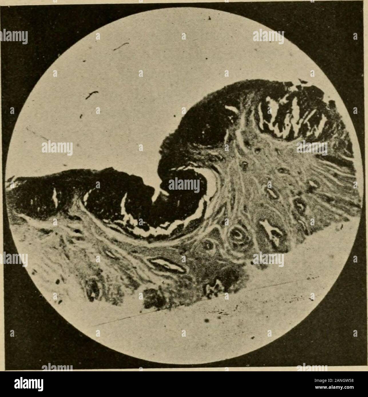 Veterinary obstetrics, including the diseases of breeding animals and ...