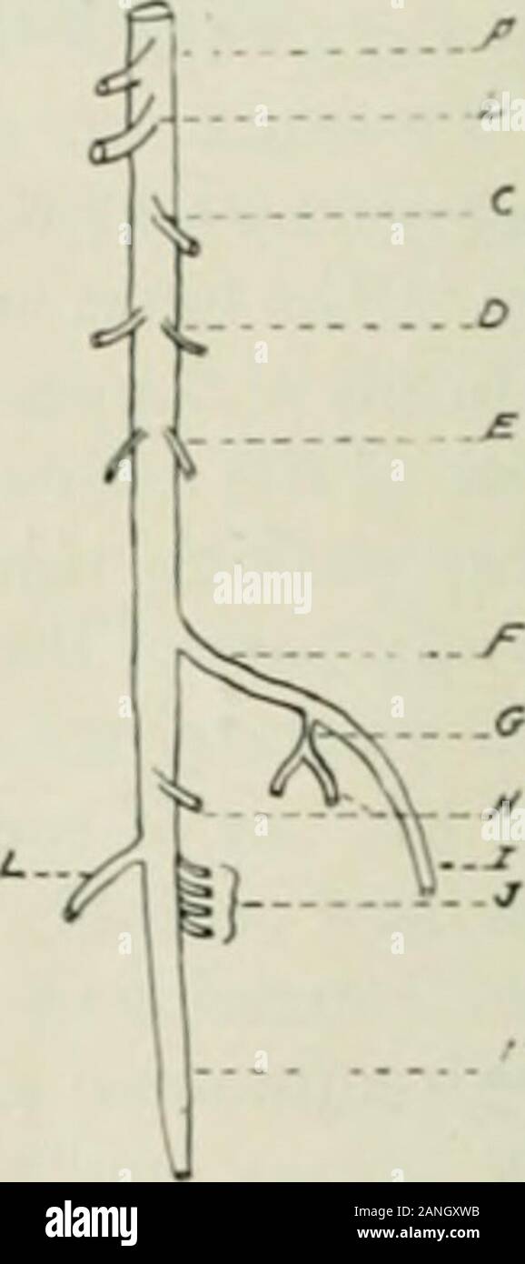 Aorta abdominal normal hi-res stock photography and images - Alamy