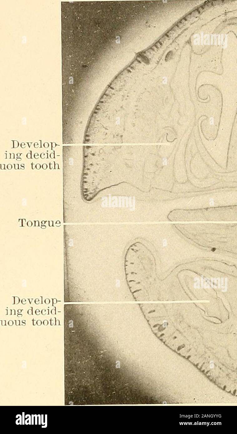 Human hone hi-res stock photography and images - Alamy