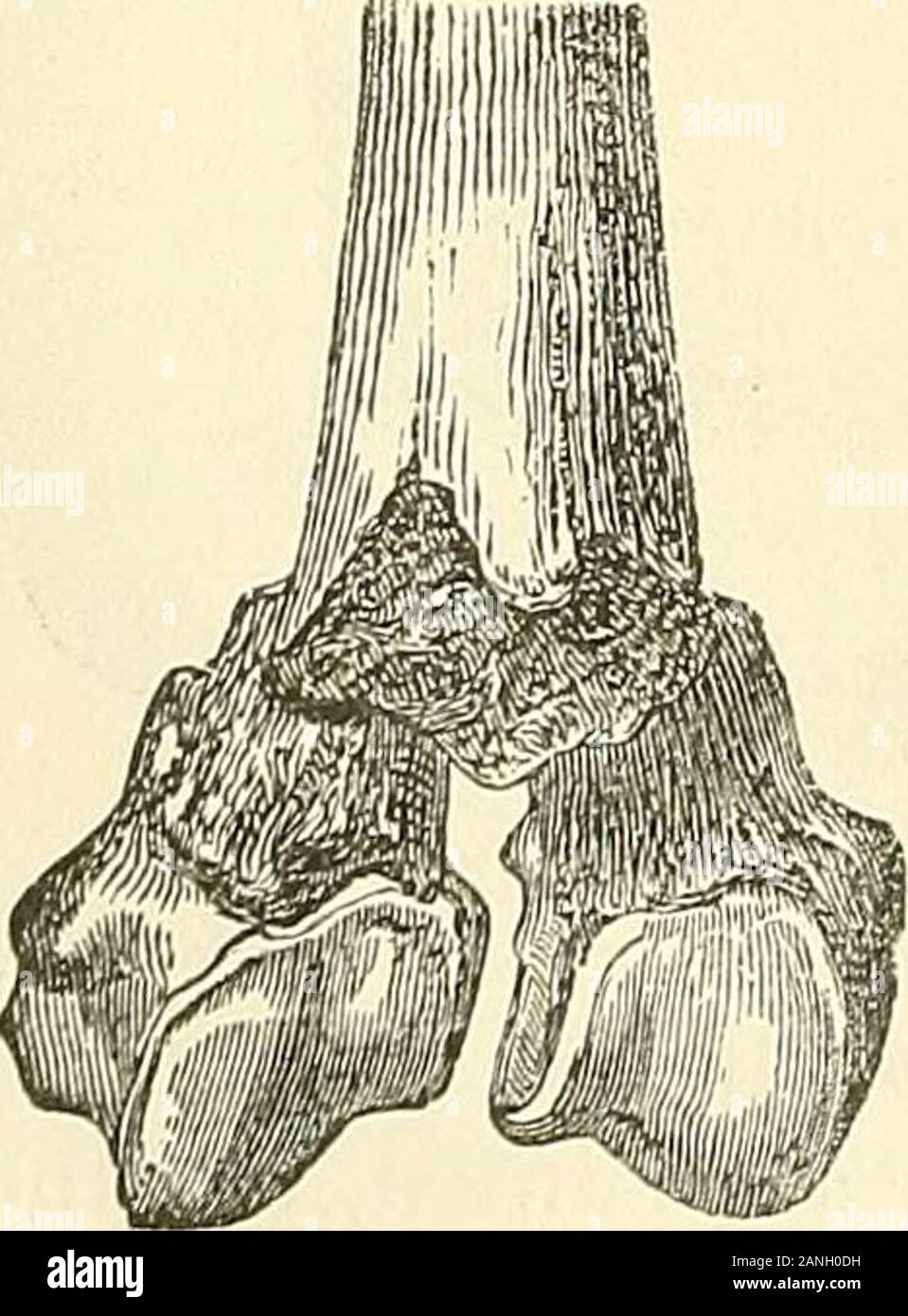 Olecranon Process High Resolution Stock Photography and Images - Alamy
