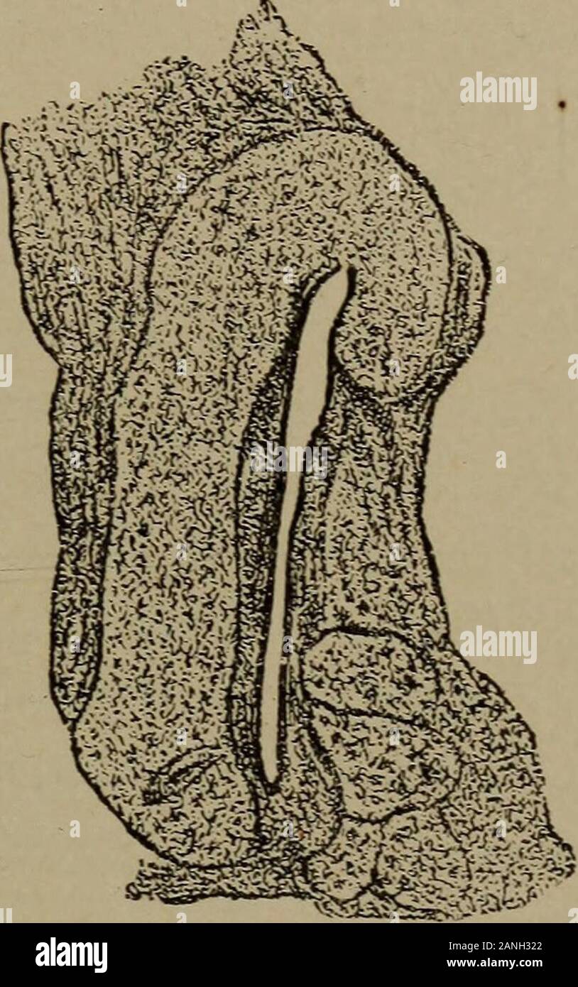 Tympanic otitis hi-res stock photography and images - Alamy