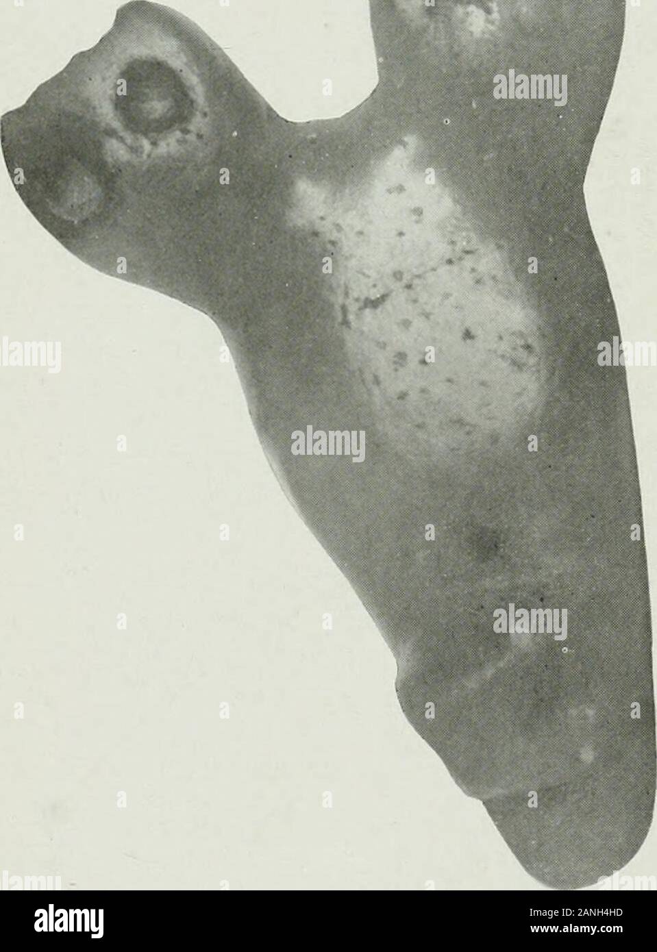 Gouged legs hi-res stock photography and images - Alamy