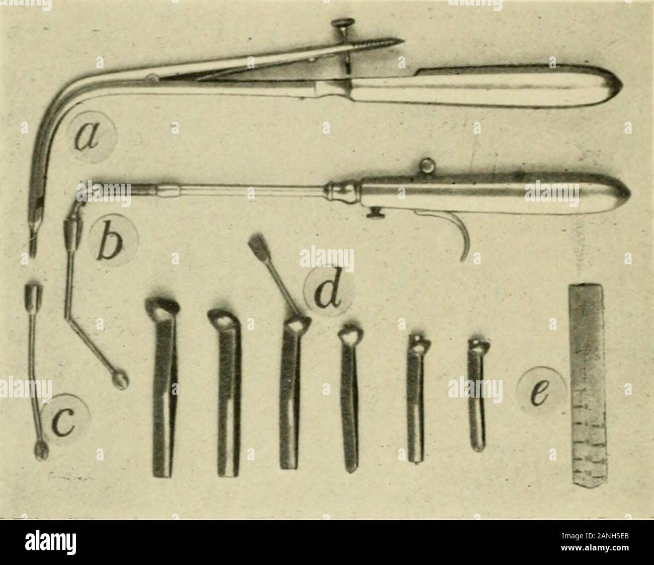 Operative surgery . Fig. 1276.—Tlie operation of subhyoid pliarvngotomy ...