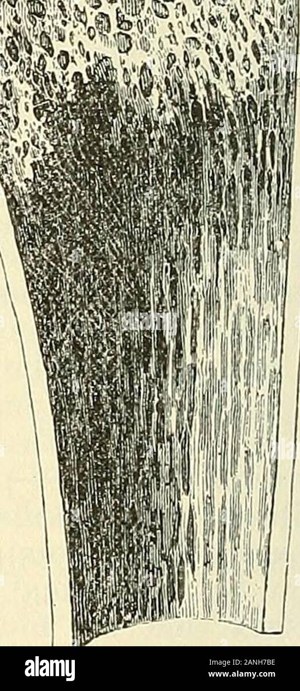 A practical treatise on fractures and dislocations . NfiM. Penetration ...