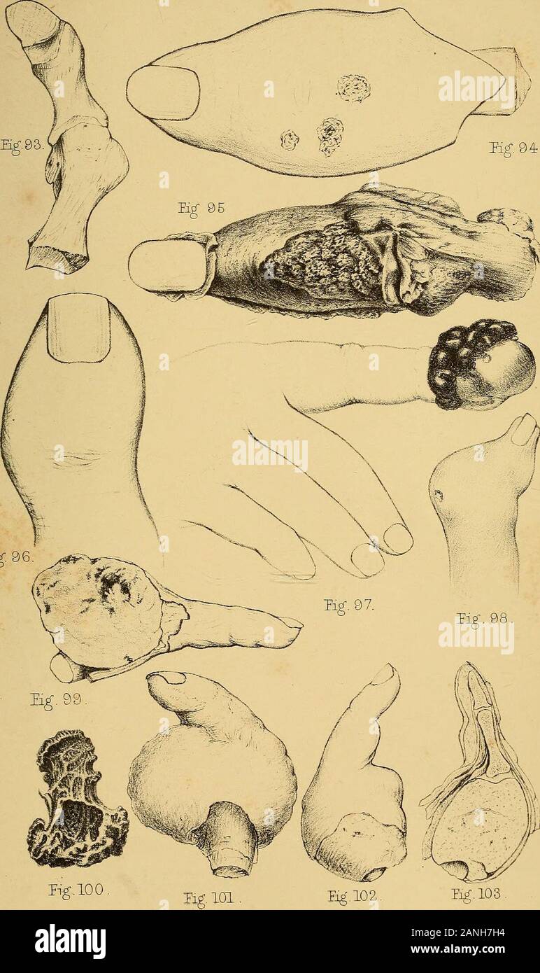The malformations, diseases and injuries of the fingers and toes and ...