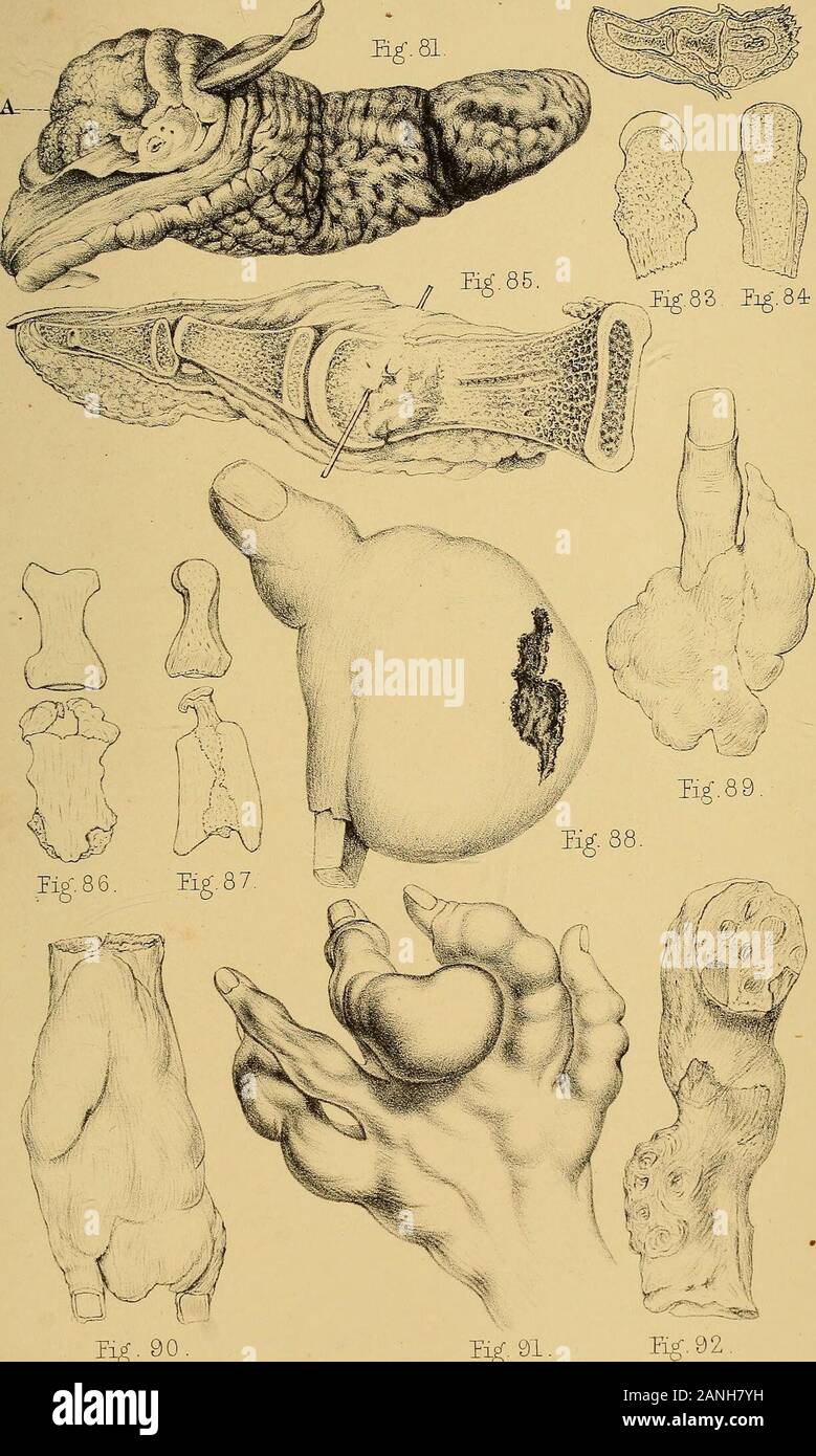 Articulated toes hi-res stock photography and images - Alamy