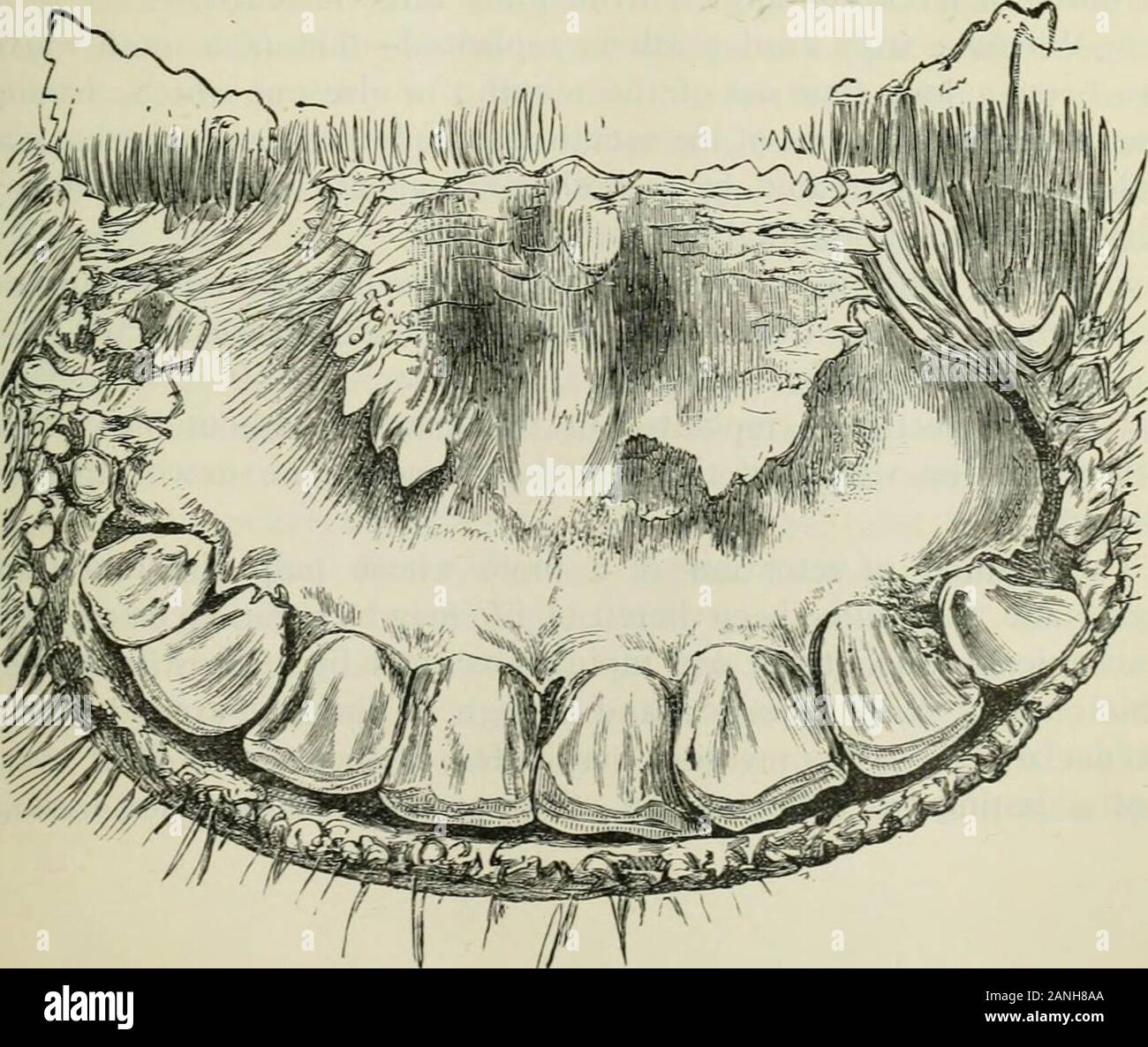 Dental form depicted hi-res stock photography and images - Alamy