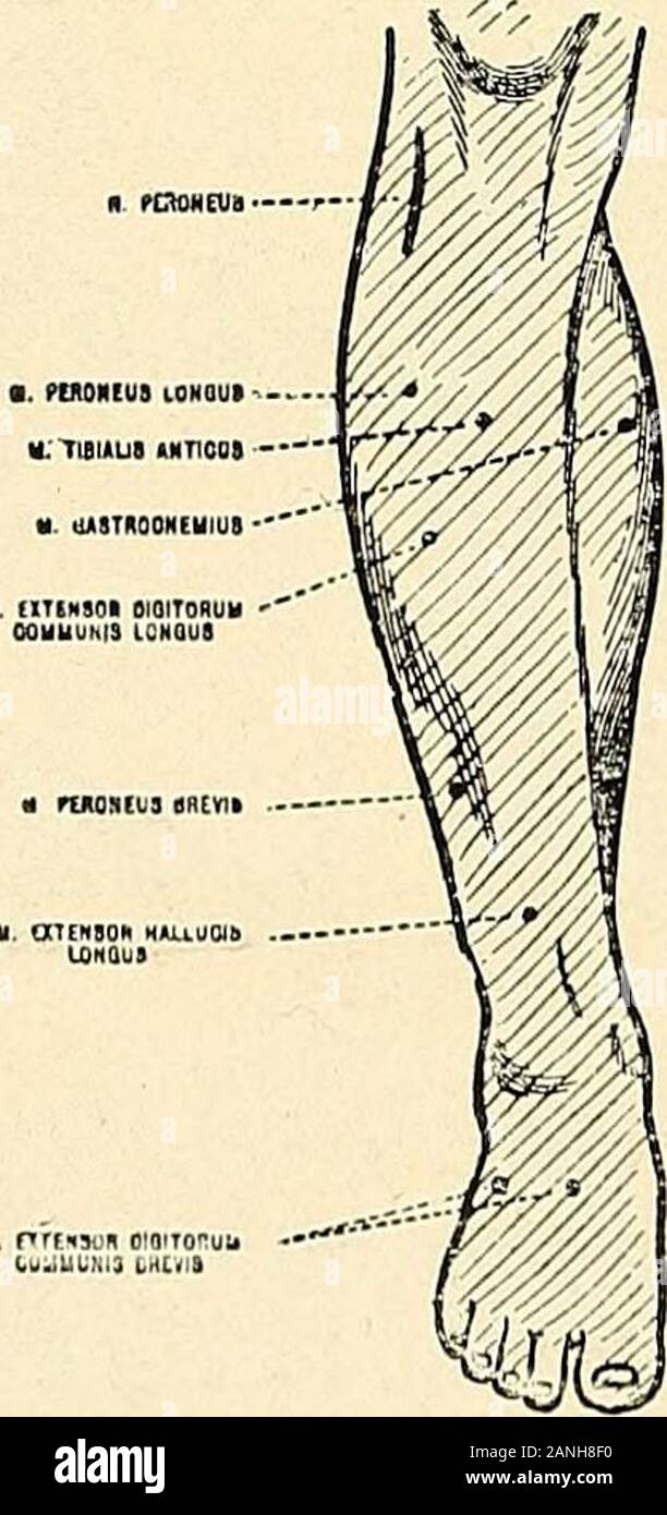 Achilles heel a hi-res stock photography and images - Alamy