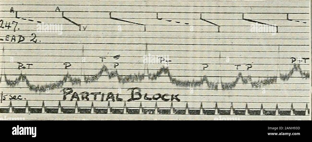 Diseases of the chest and the principles of physical diagnosis . 1