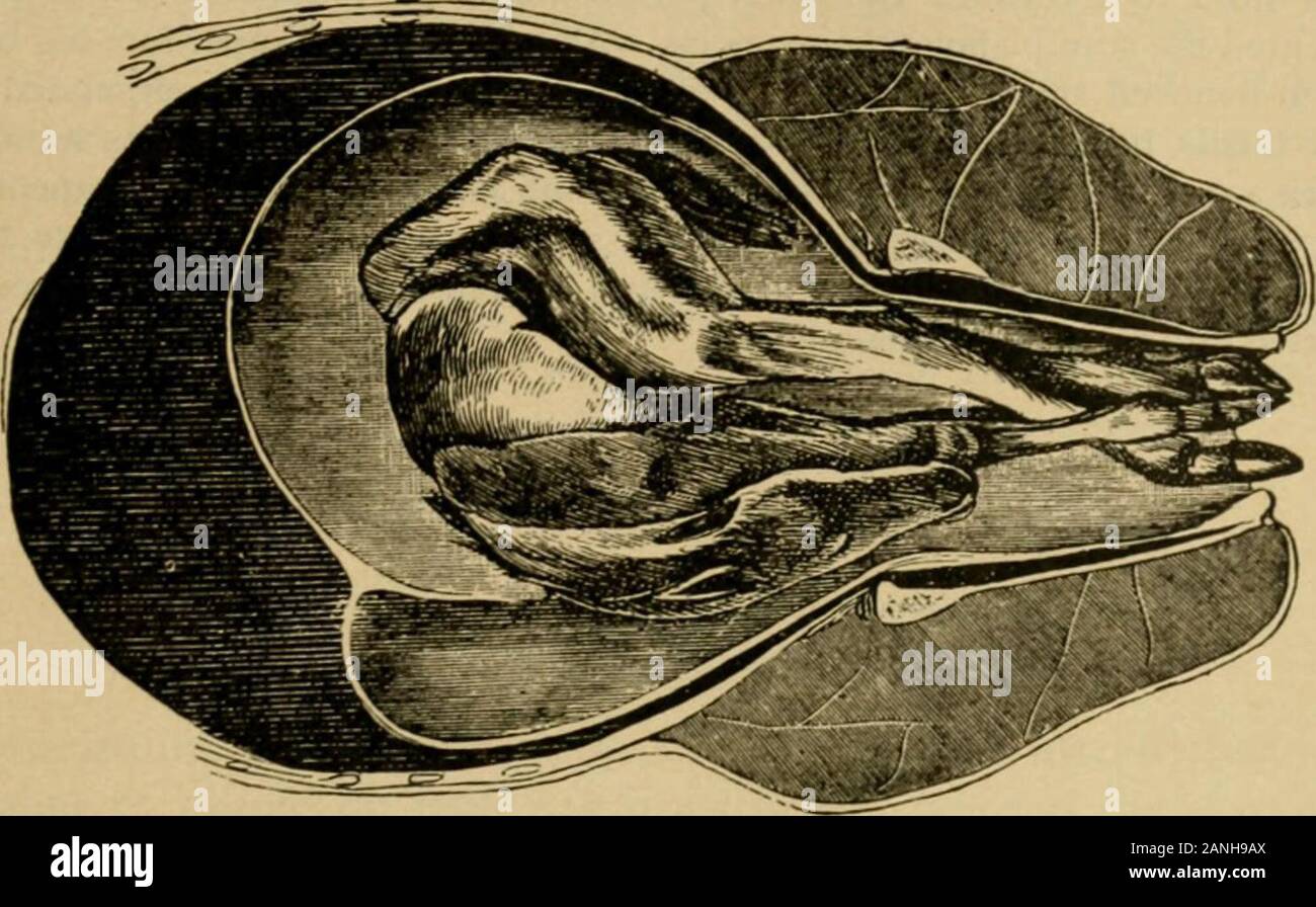 789 new cases hi-res stock photography and images - Alamy