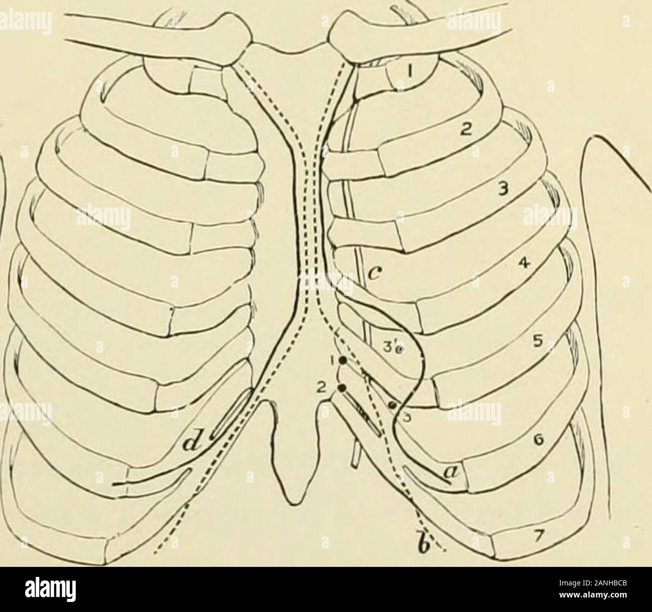 Chest wall injury hi-res stock photography and images - Alamy