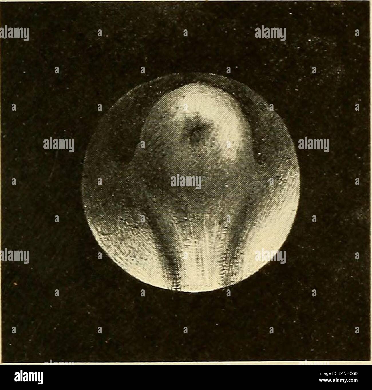 Gonorrhea in the male : a practical guide to its treatment ...