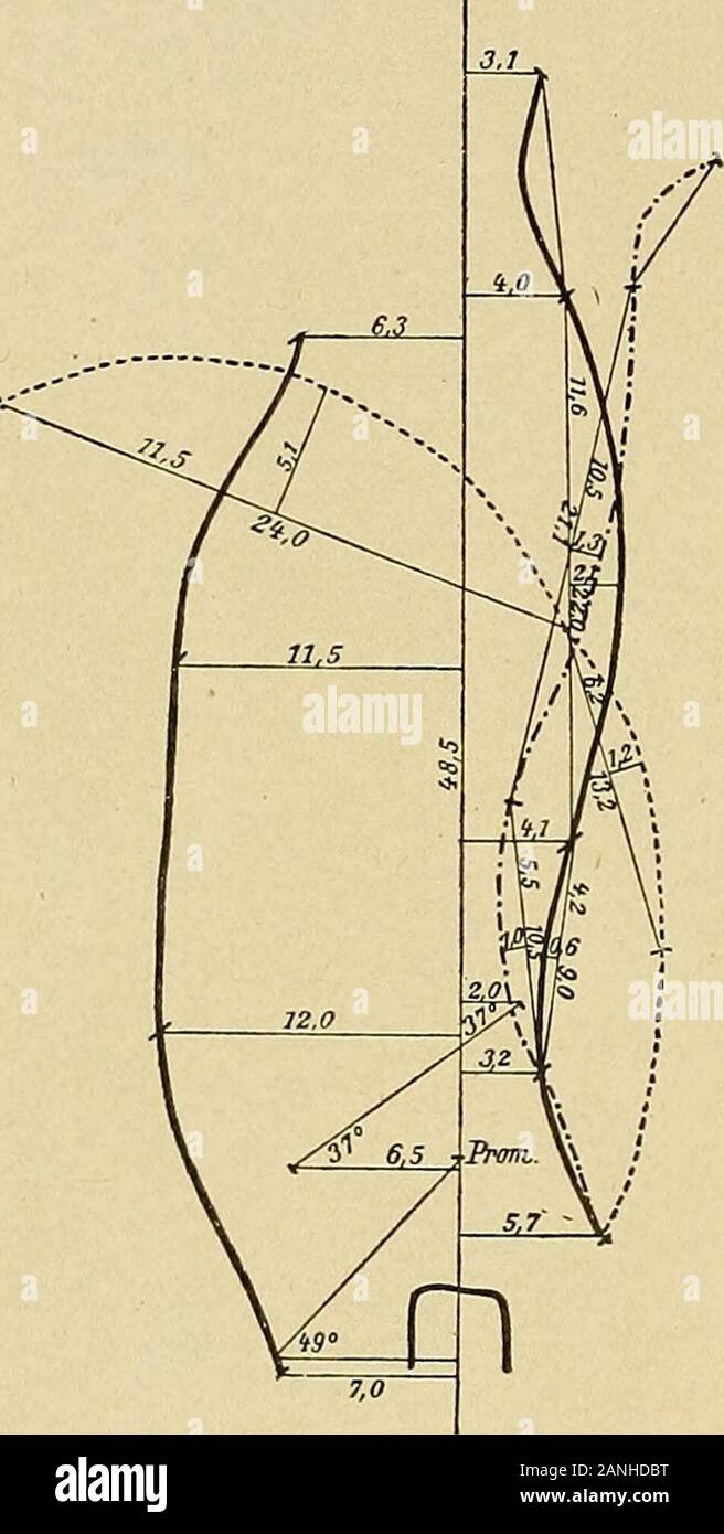 Lateral curvature of the spine and round shoulders . al bodies alone ...