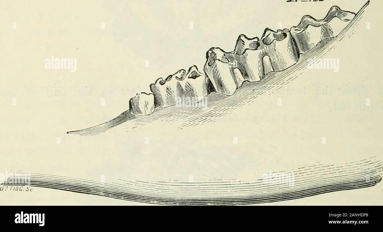 Fourth molar hi-res stock photography and images - Alamy