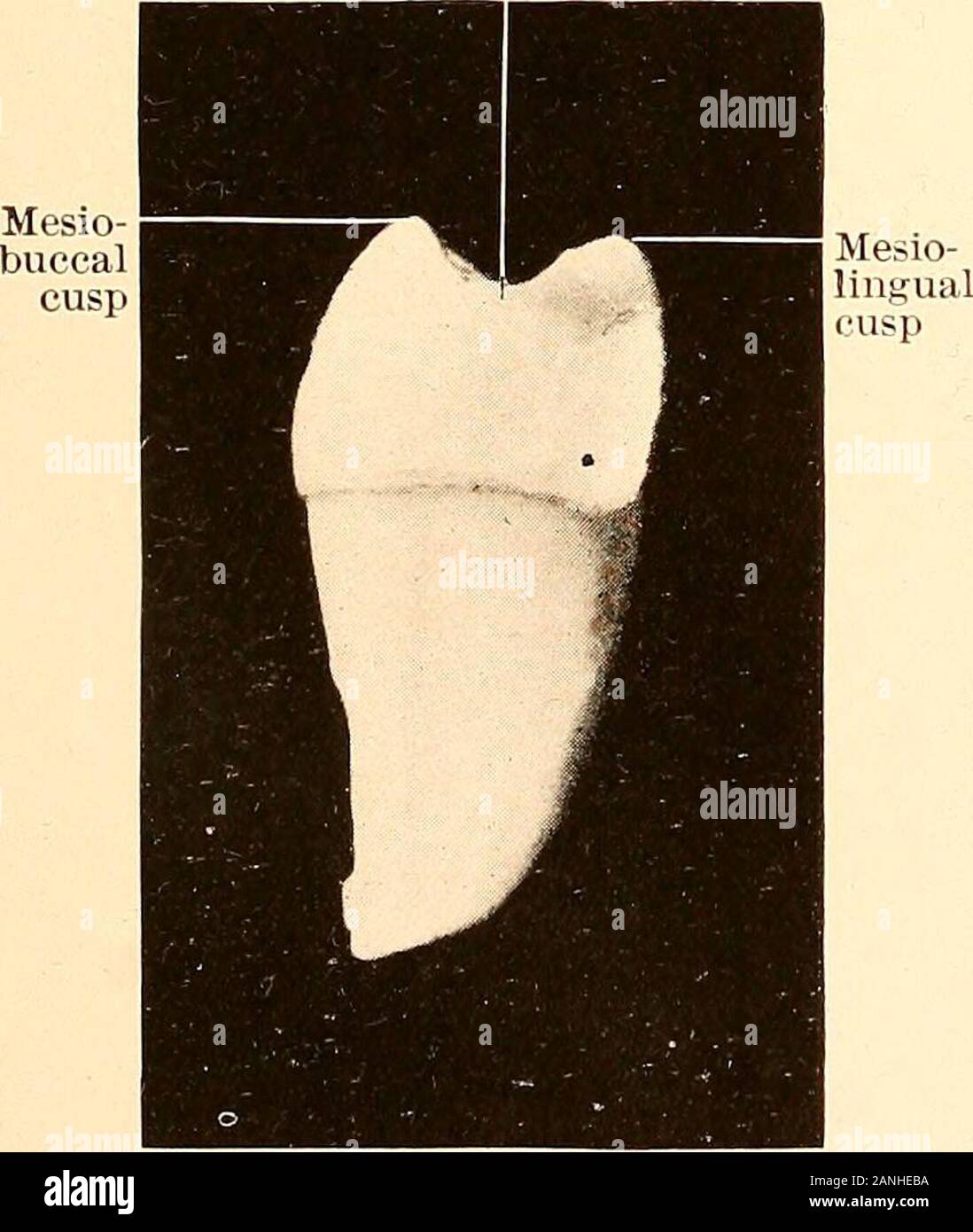 Molar inferior hi-res stock photography and images - Alamy