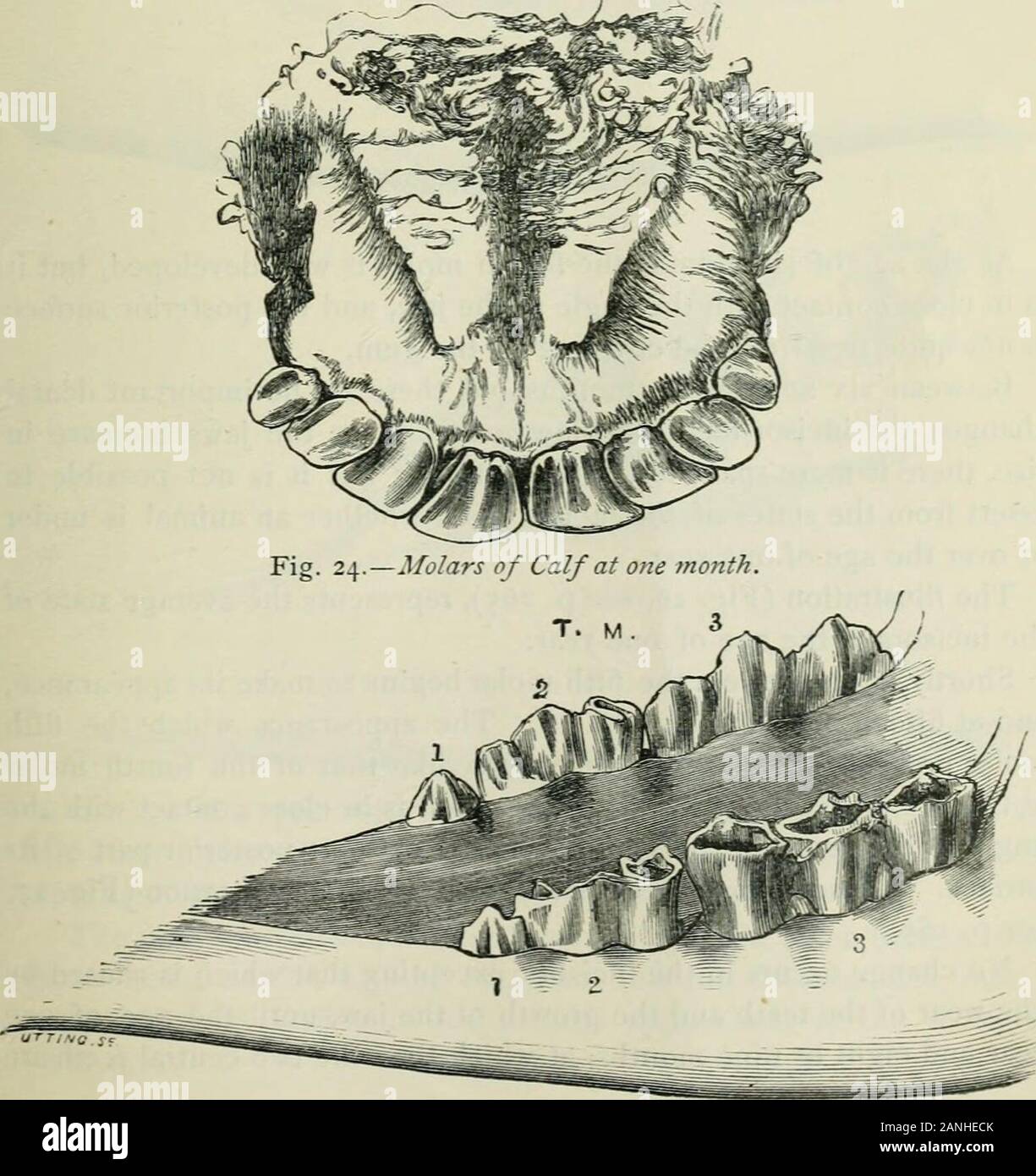 Fourth molar hi-res stock photography and images - Alamy