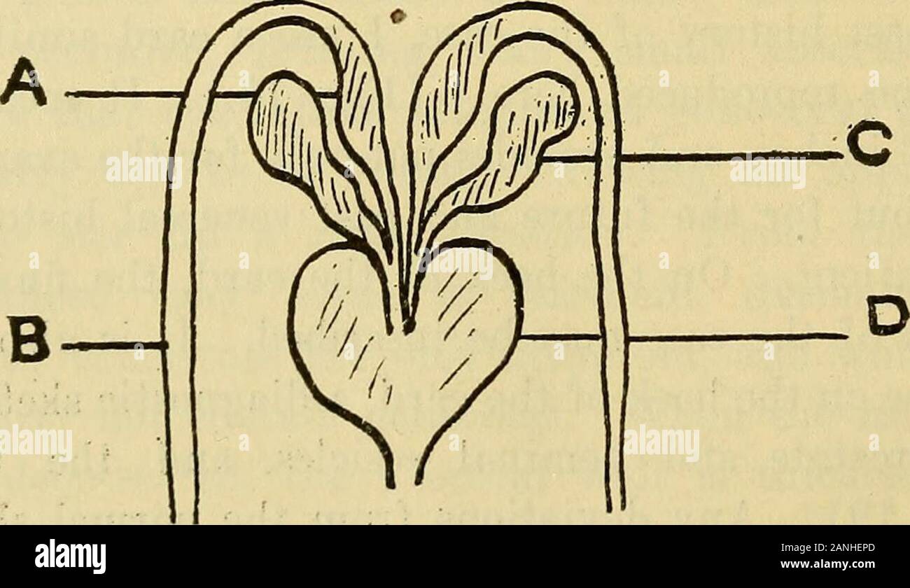 Gonorrhea Drawing