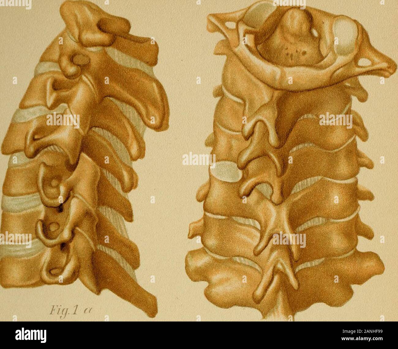 Atlas and epitome of traumatic fractures and dislocations . tion is ...