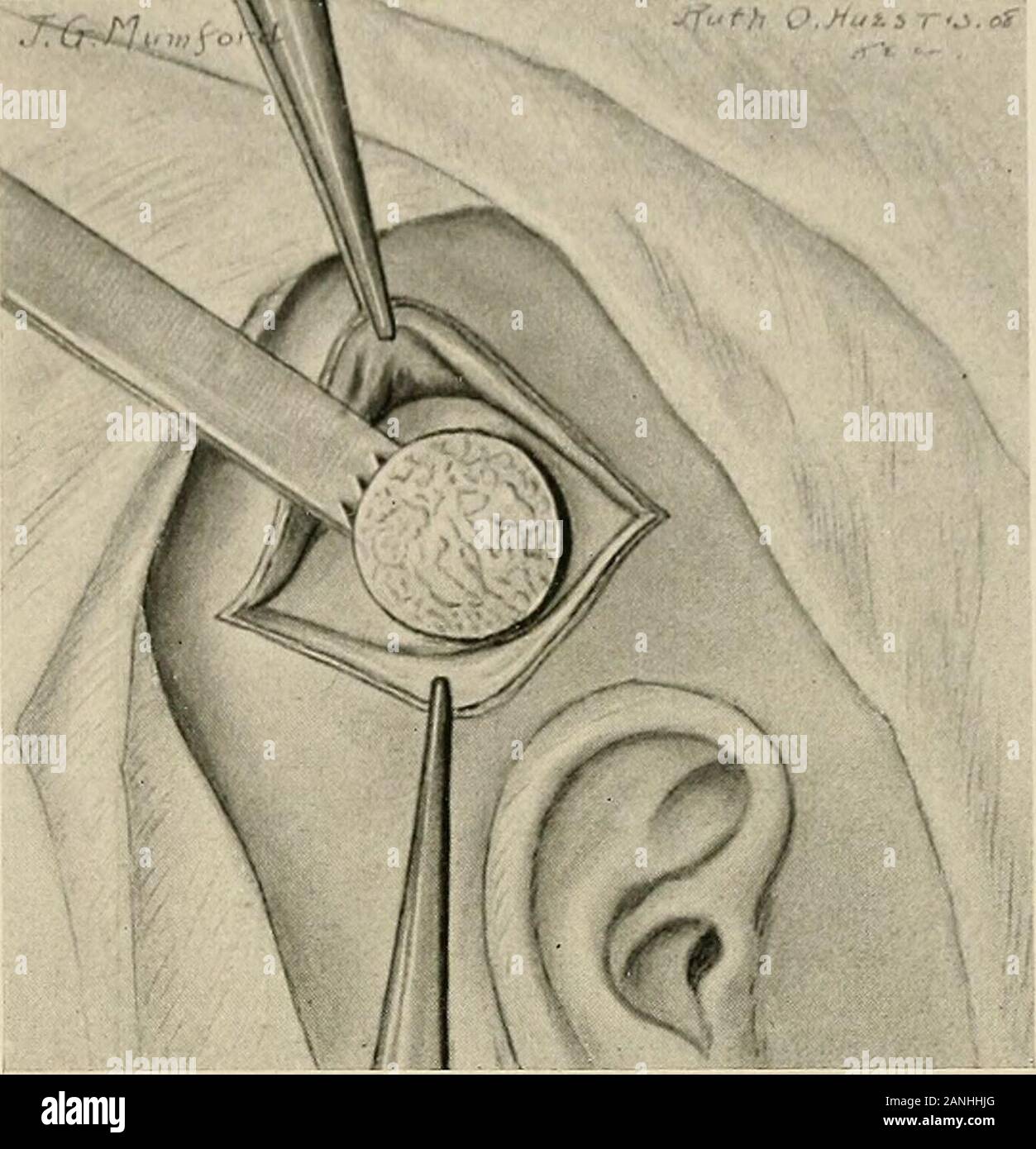 The practice of surgery . - attaina great size, and may so far involve ...