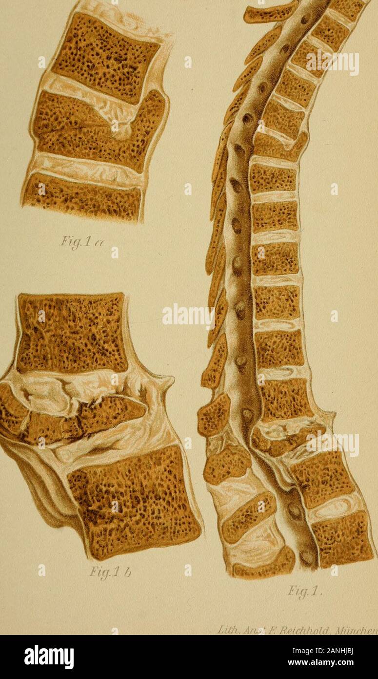 Lordosis equina hi-res stock photography and images - Alamy