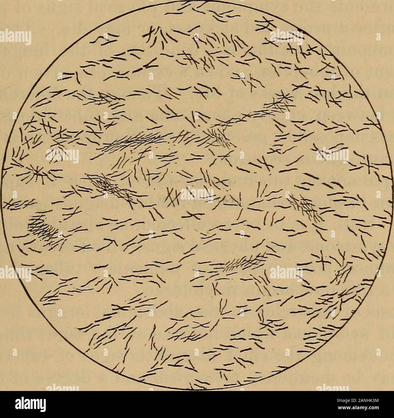 A treatise on the diseases of infancy and childhood . ds are still ...