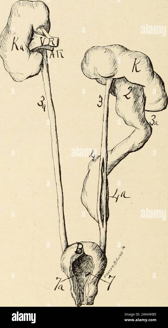 Distal ureter hi-res stock photography and images - Alamy
