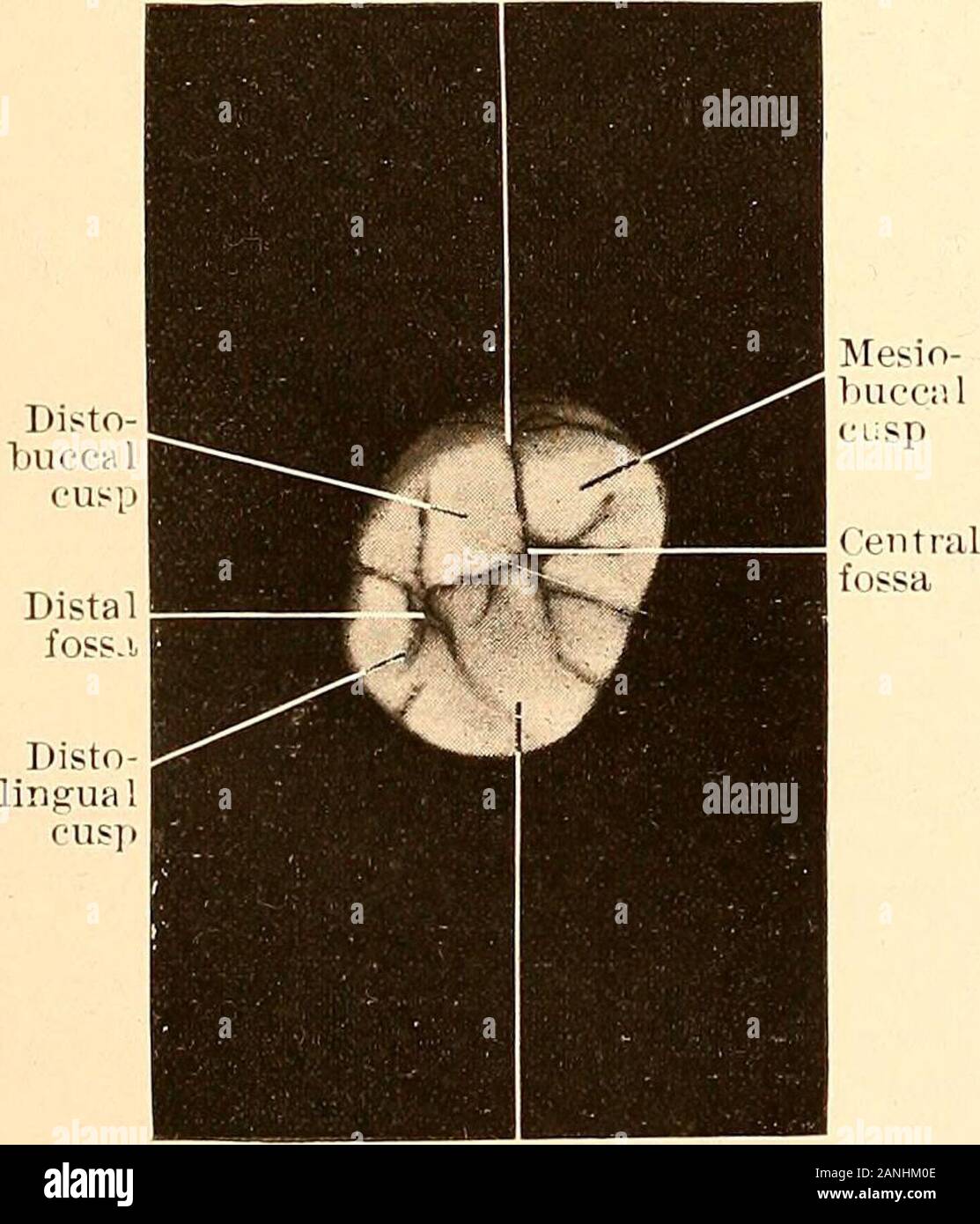 Principles and practice of operative dentistry . Mesial grooveFig. 65 ...