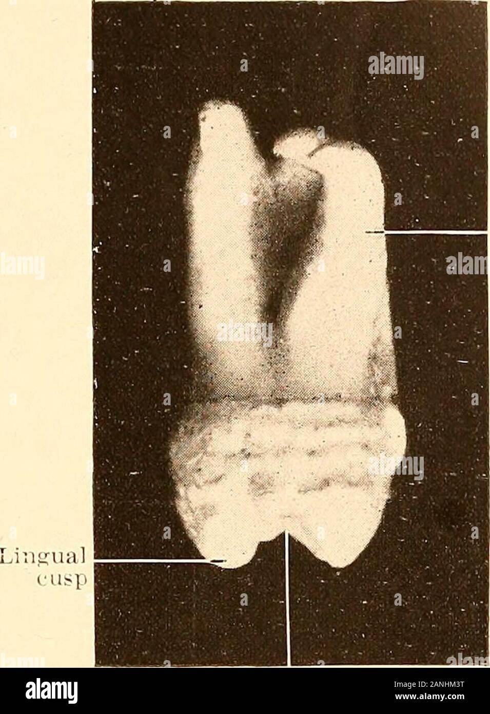 Molar groove hi-res stock photography and images - Alamy