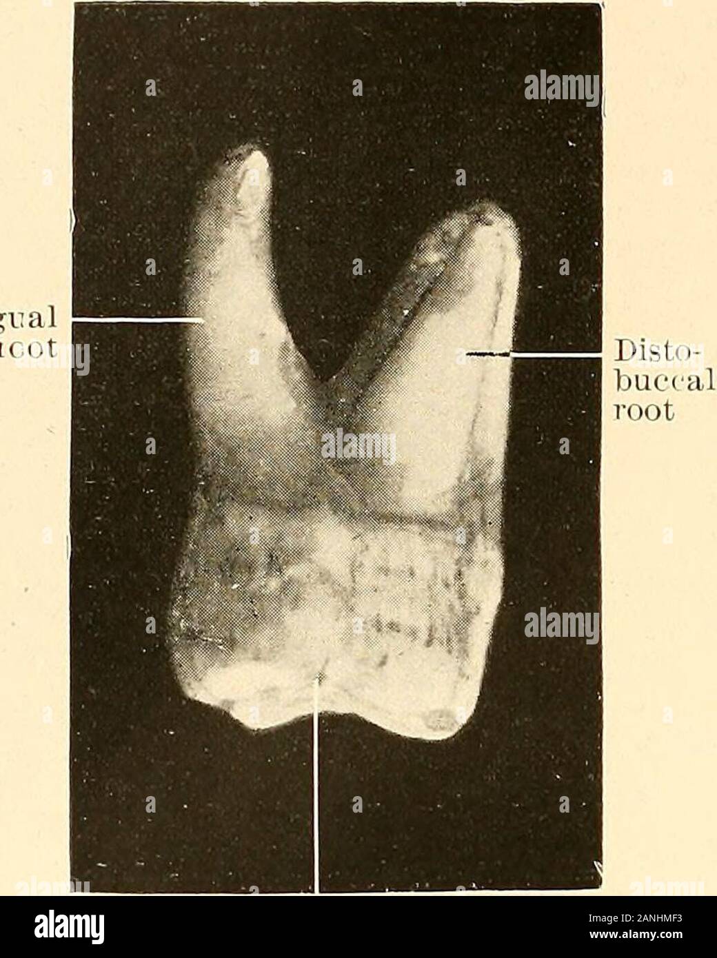Principles and practice of operative dentistry . Fig. 60.—Superior ...