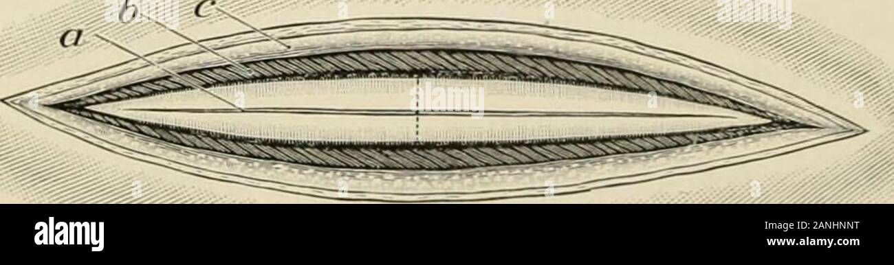 Seventh rib hi-res stock photography and images - Alamy