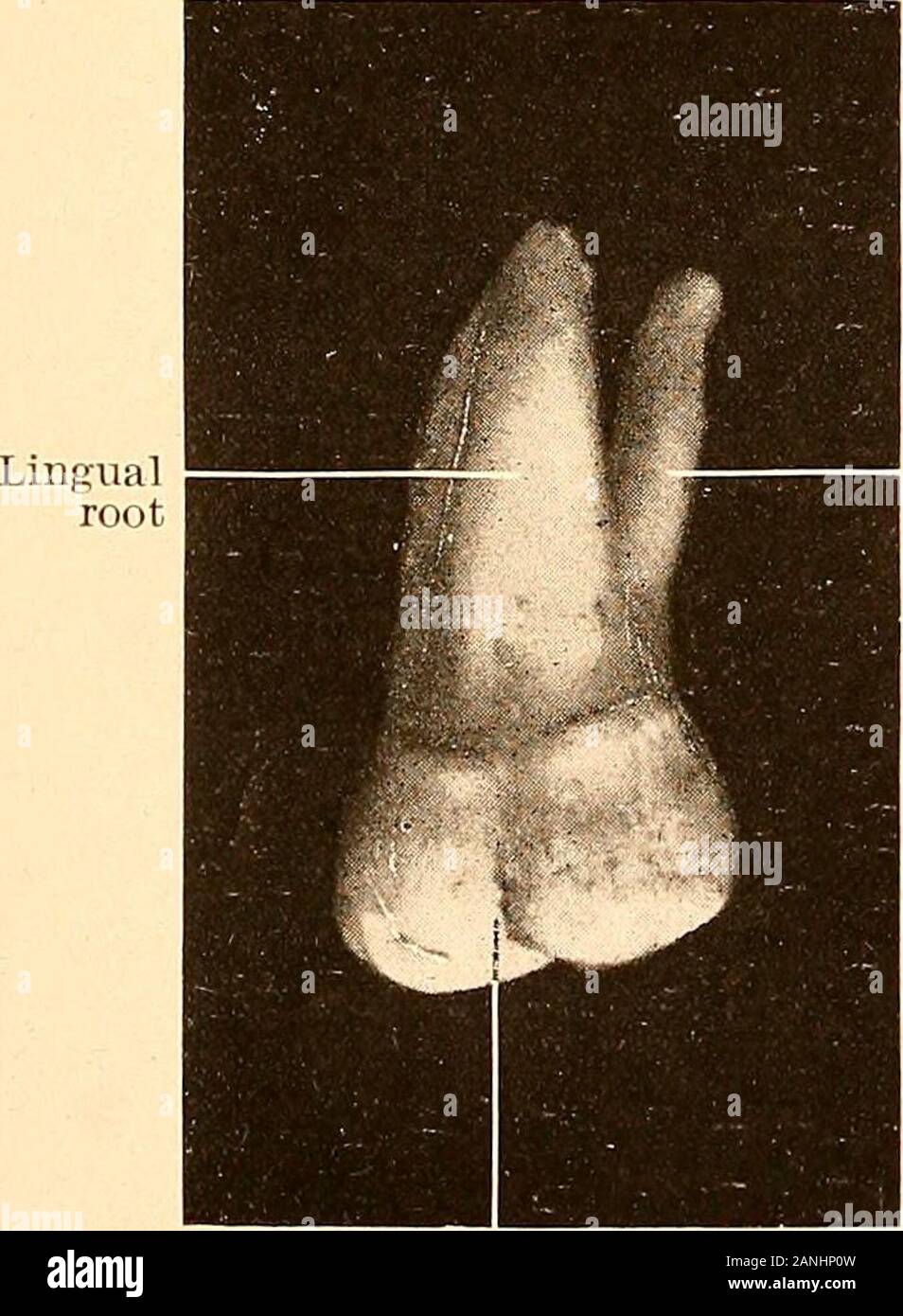 Disto hi-res stock photography and images - Alamy