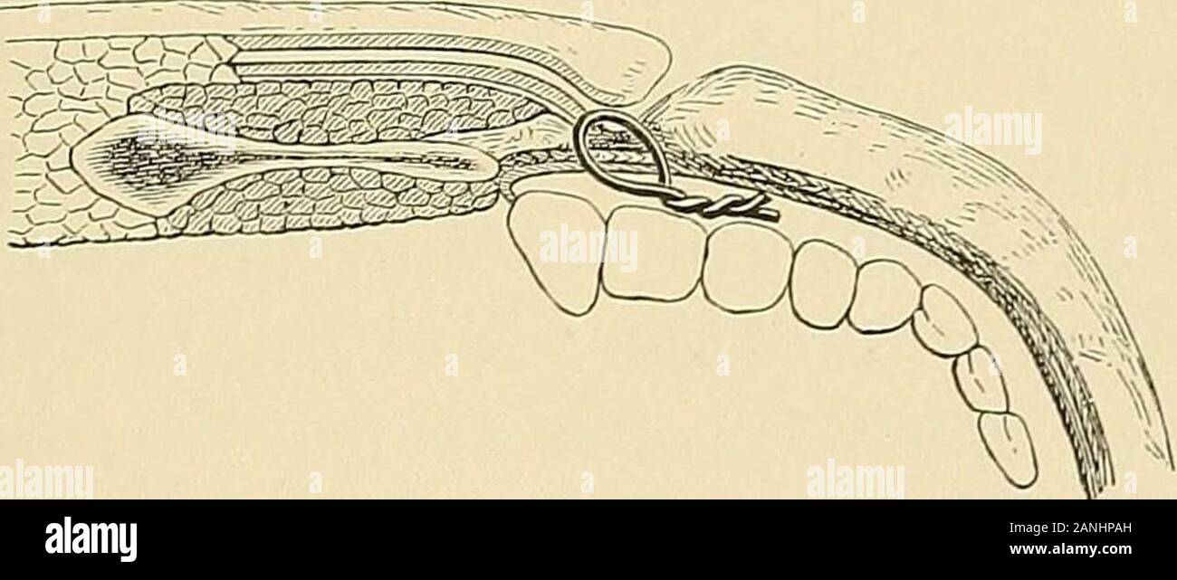 Oral surgery; a text-book on general surgery and medicine as applied to ...
