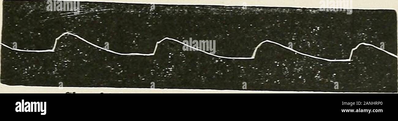 Water hammer pulse hi-res stock photography and images - Alamy