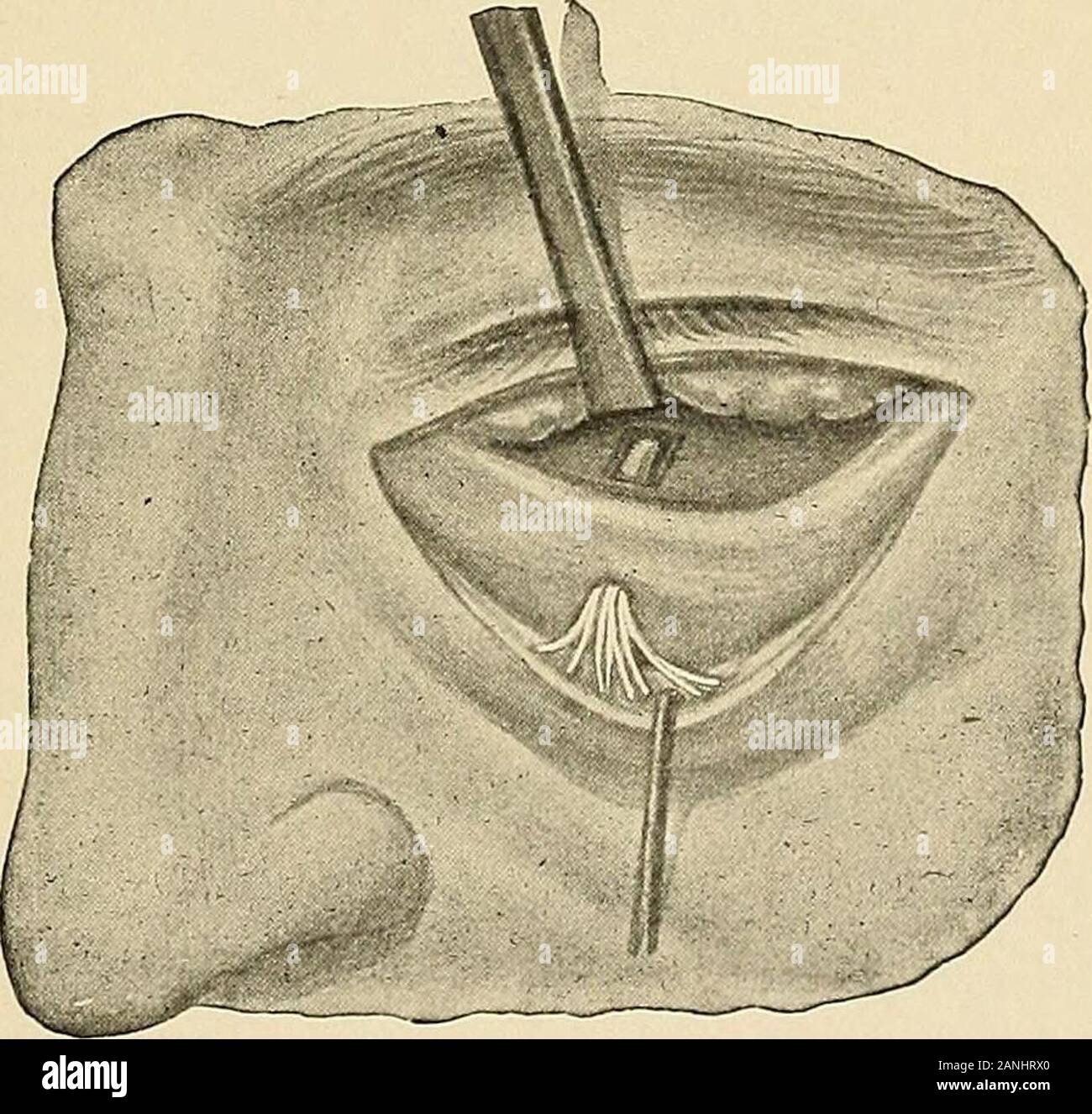 Infraorbital foramen hi-res stock photography and images - Alamy